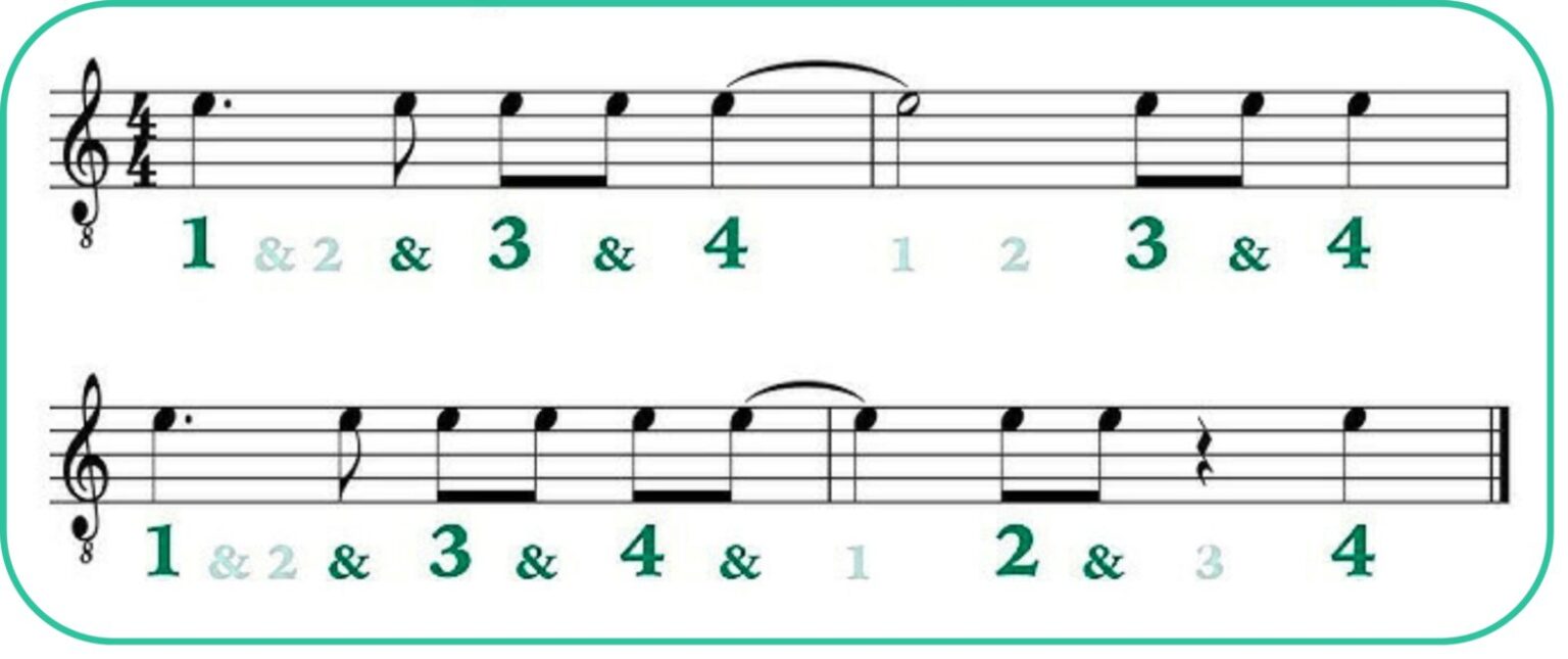 Ties and slurs in music and how to spot them in notation | Skoove