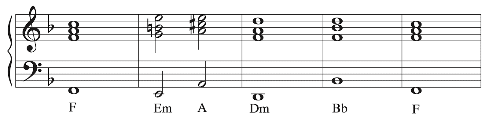Did the progressions above remind you of any songs? Well, that’s likely ...